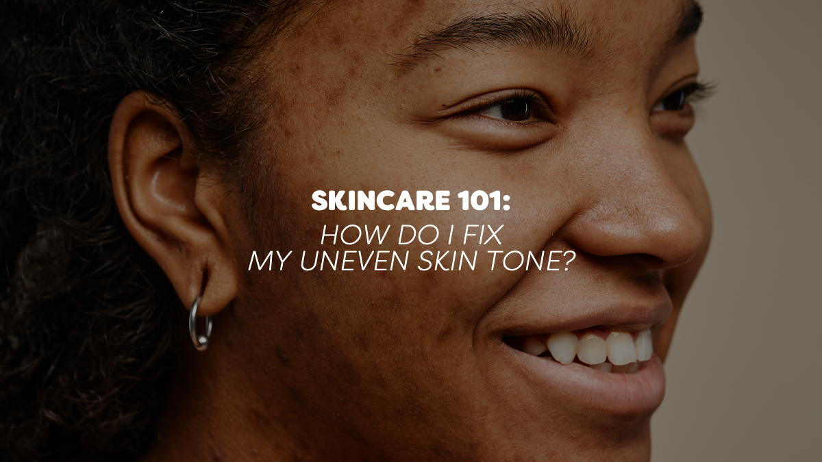 Skincare 101: How to Improve Uneven Skin Tone – Peaches&Crème K-Beauty ...
